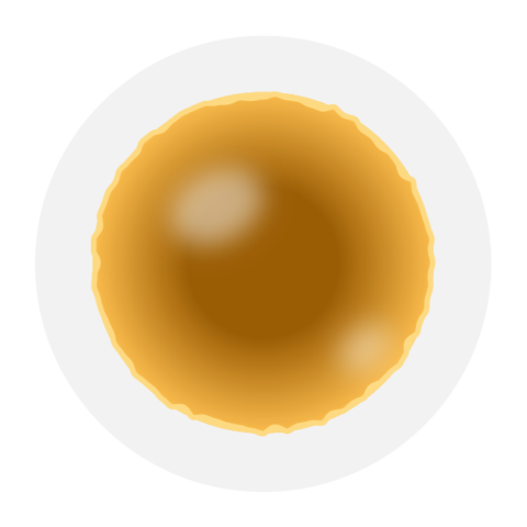 Cataract Development – Southwestern Eye Center